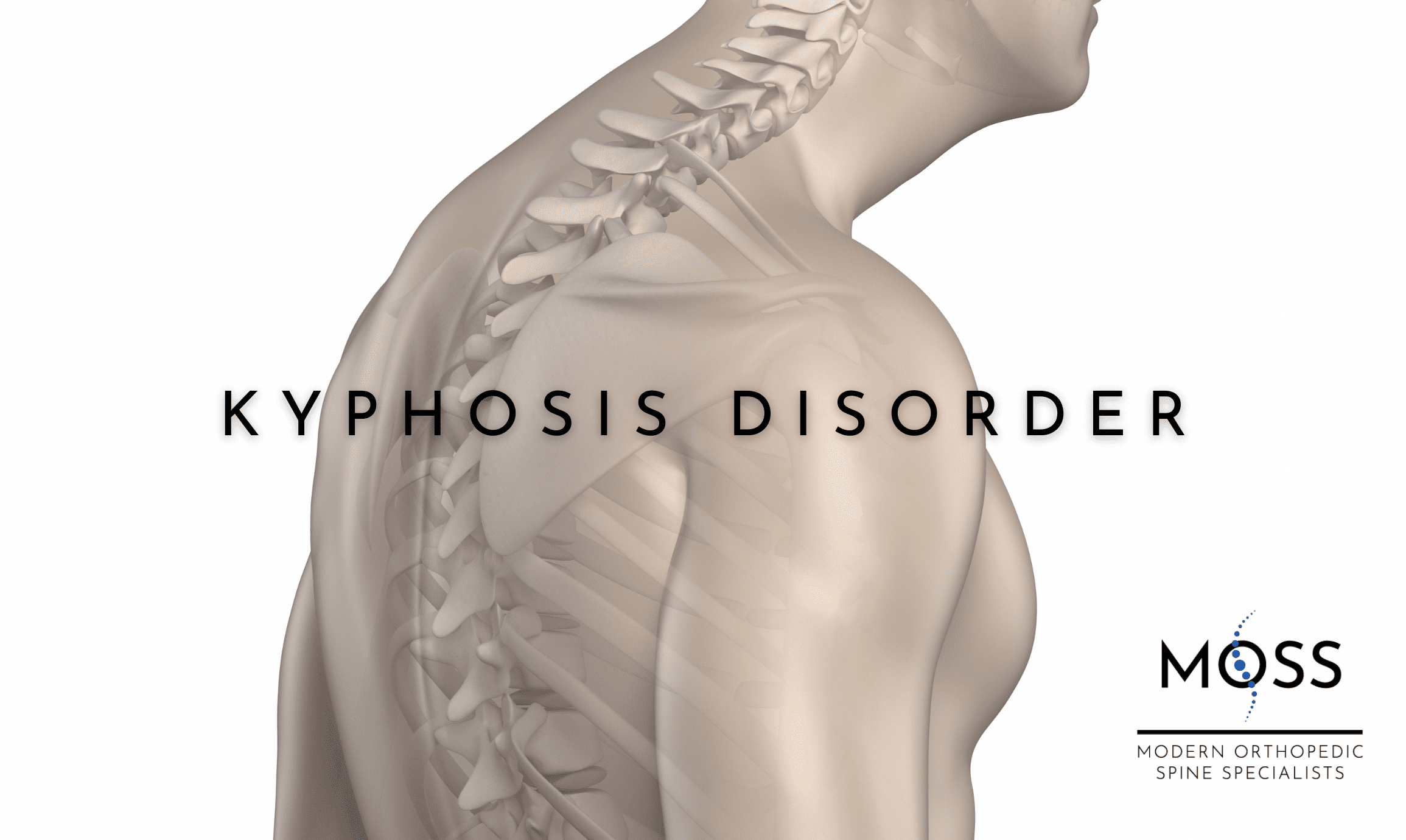 Kyphosis Disorder - Modern Orthopedic Spine Specialists